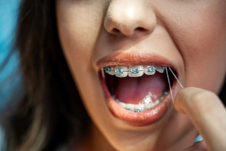 Serenity Orthodontics Blog | Orthodontist Blog Cumming, GA